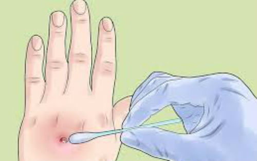 儿童 MRSA 感染：家居物品暗藏“杀机”_生物探索